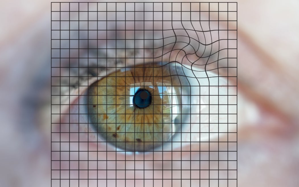 New technology developed for eye disease early detection | New Zealand ...